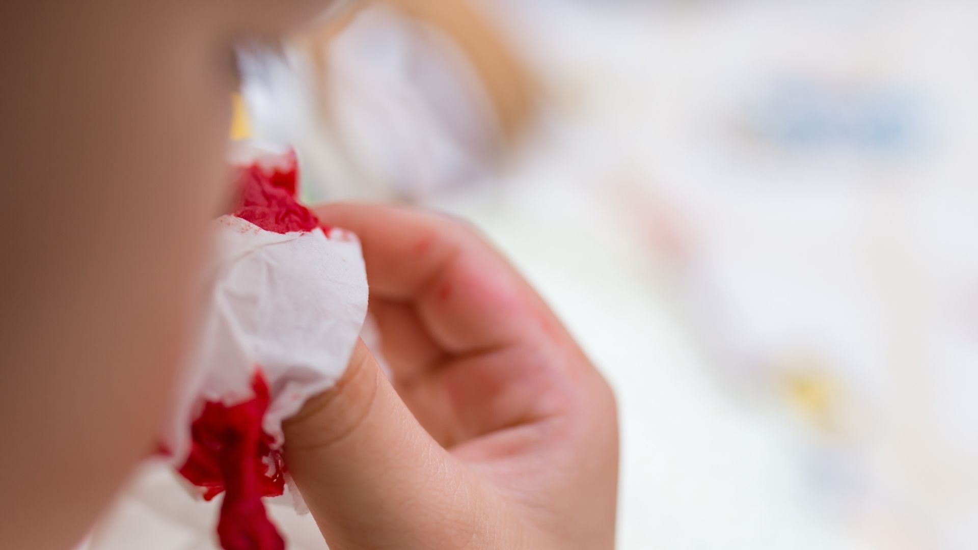 Nasal bleeding (epistaxis) in adults – Perfect Shape Fit